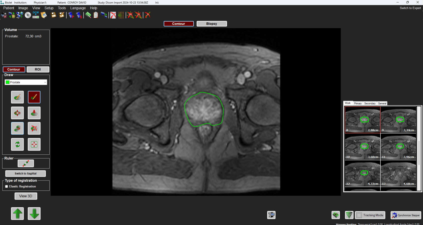 Medical engineering: Positioning systems for doctors - MTT